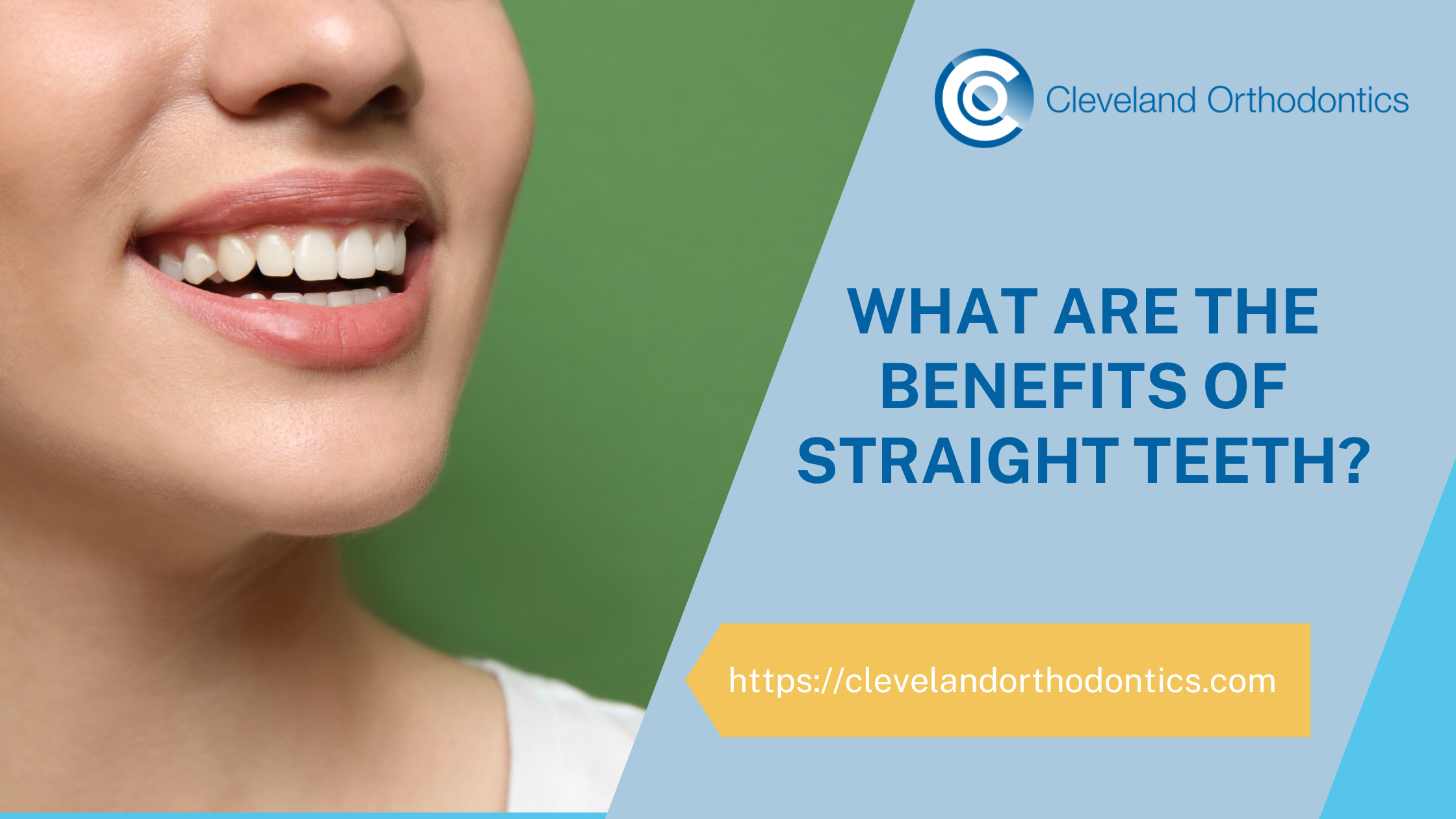 What Are The Benefits Of Straight Teeth? - Cleveland Orthodontics in ...