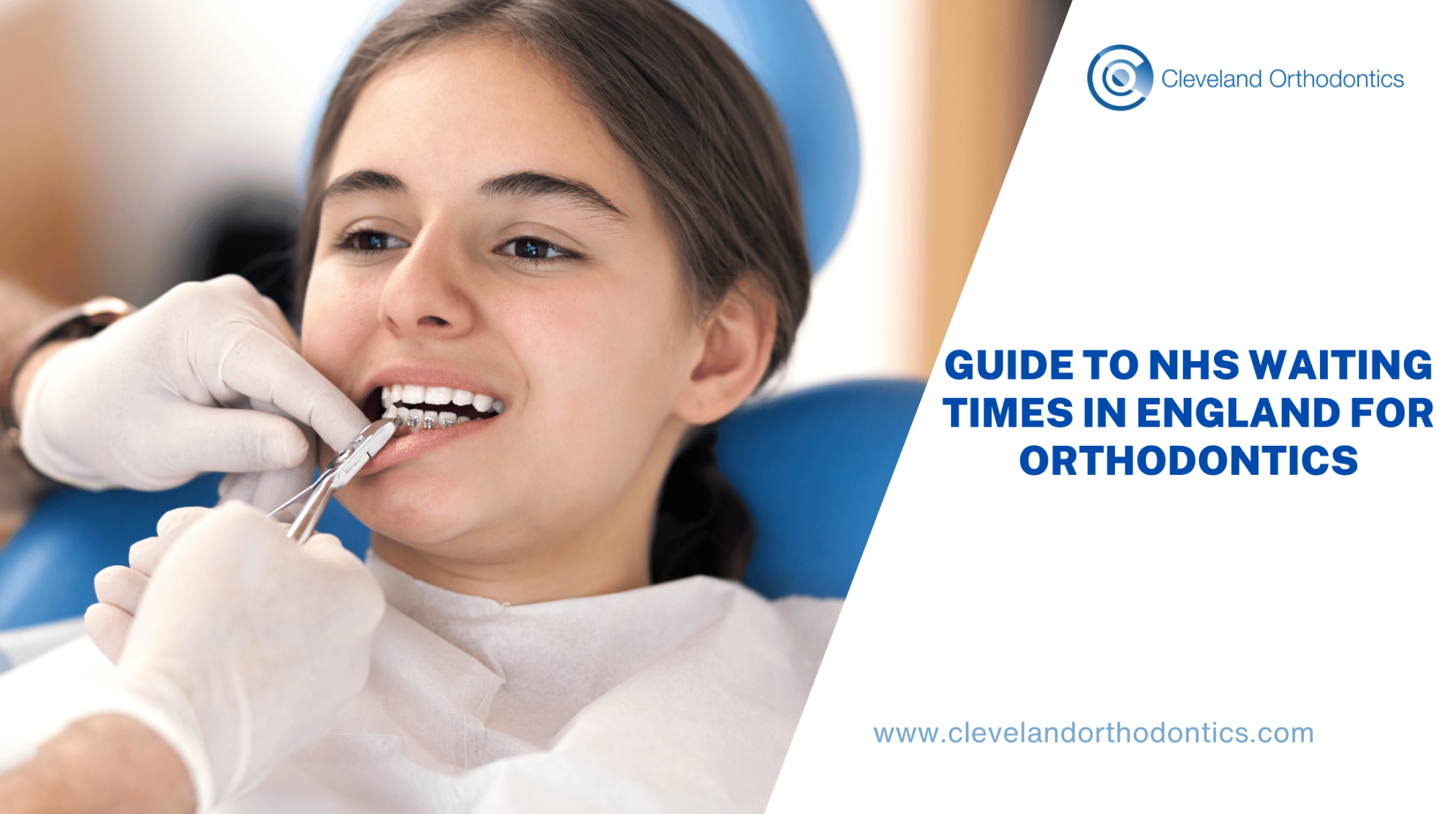 Guide To NHS Waiting Times In England For Orthodontics - Cleveland ...